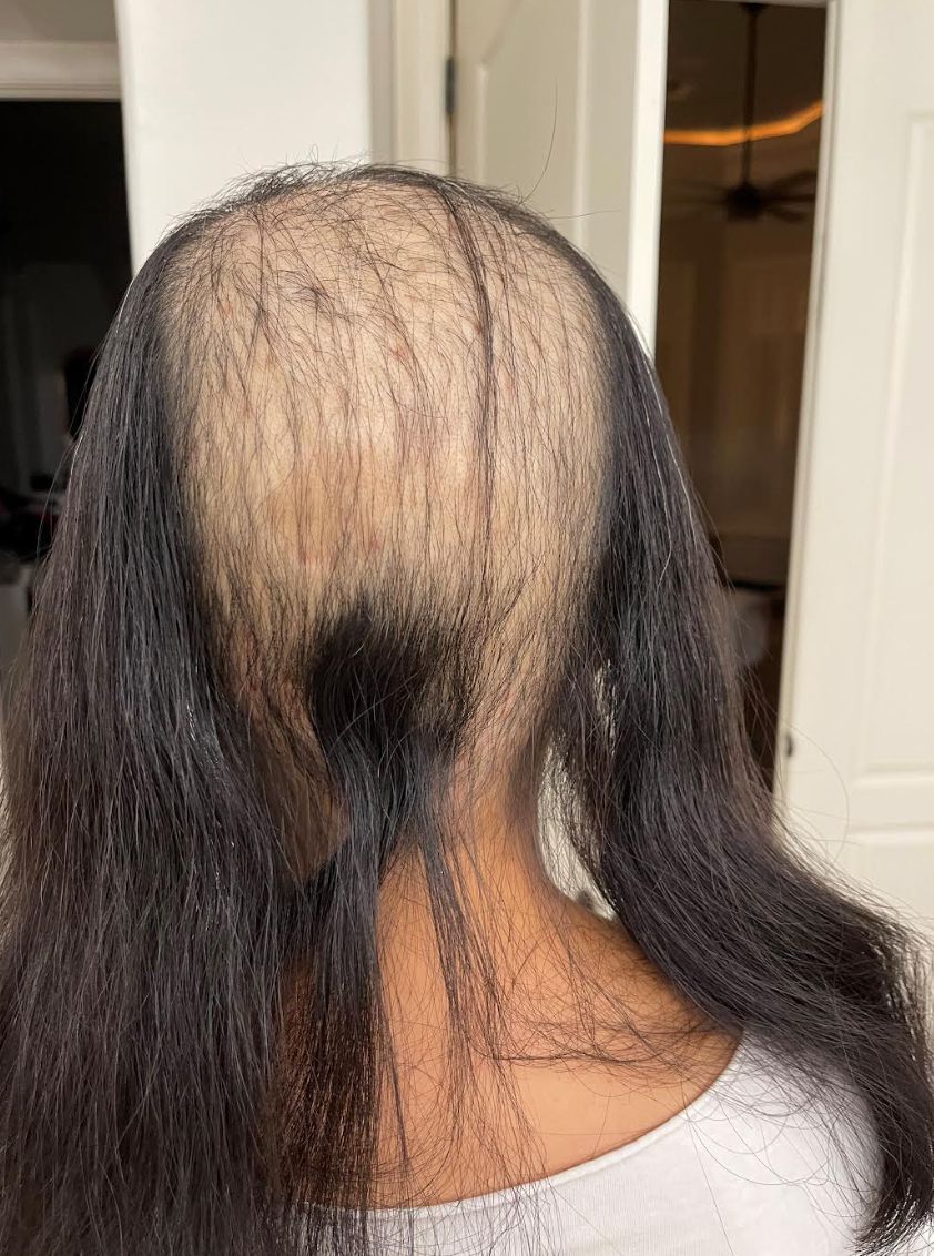 Doctor Learns From Own Breast Cancer Diagnosis