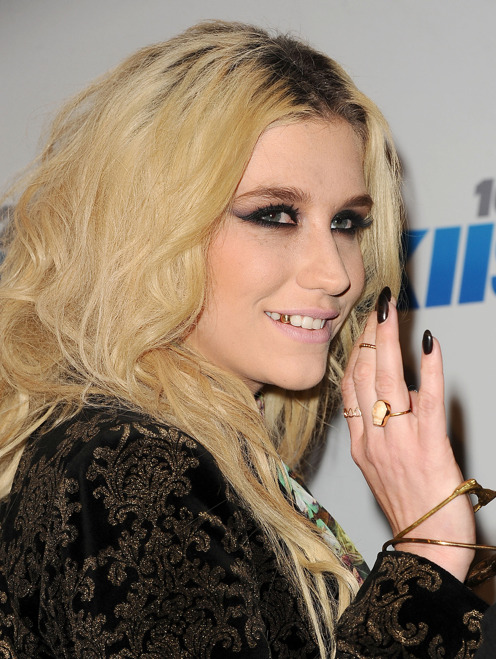 14 Ways To Style A Gold Tooth According To Ke$ha