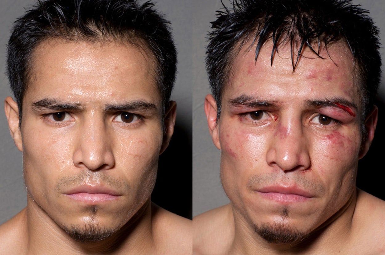 before and after fighting