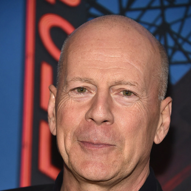 If Famously Bald Celebrities Had A Full Head Of Hair