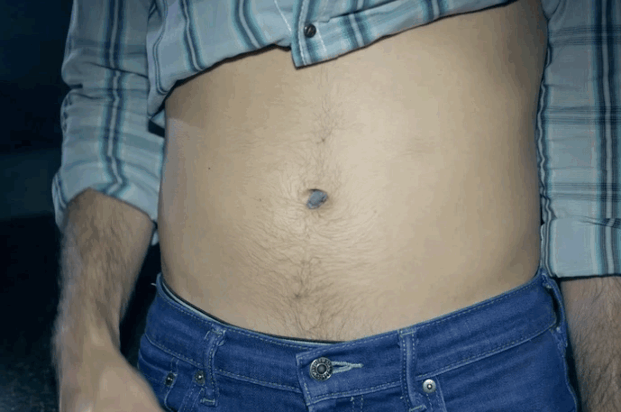 11 Slightly Horrifying Things You Never Knew About Belly Buttons