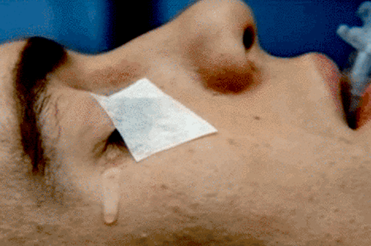 Here’s What Actually Happens When You Wake Up During Surgery