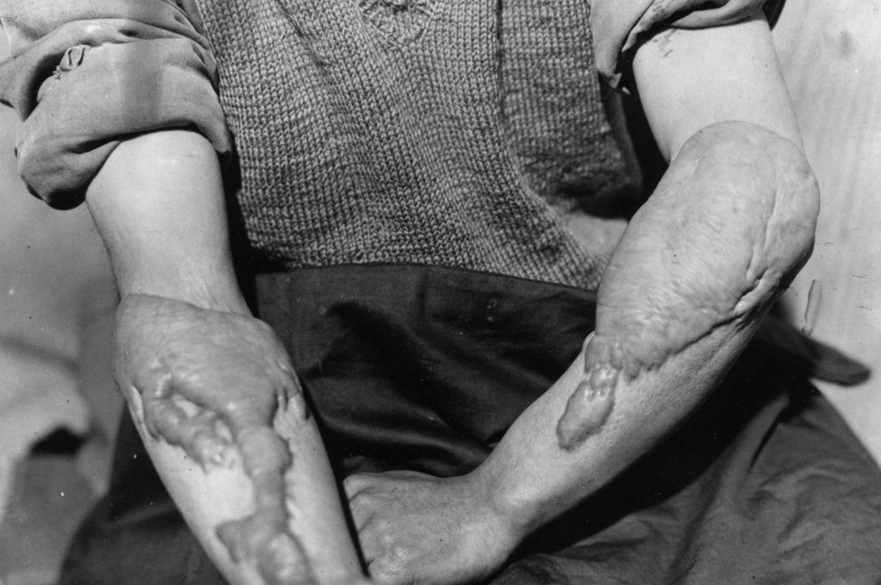 The U.S. Dropped The Atomic Bomb On Hiroshima 70 Years Ago