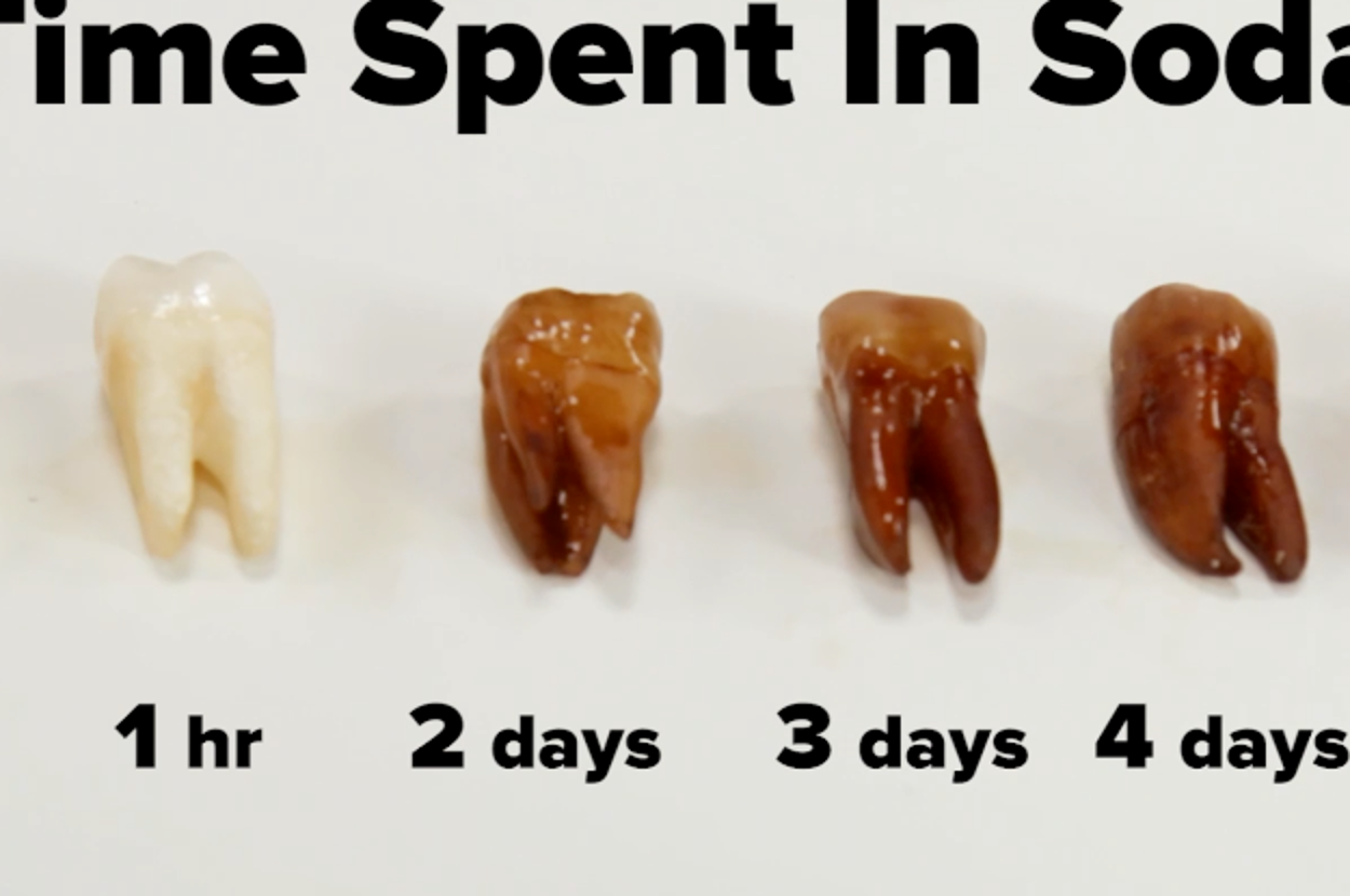 What Happens When You Put Teeth In Soda