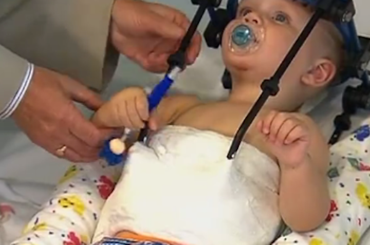 A Toddler's Head Was Reattached To His Spine After A Horrible Car Crash