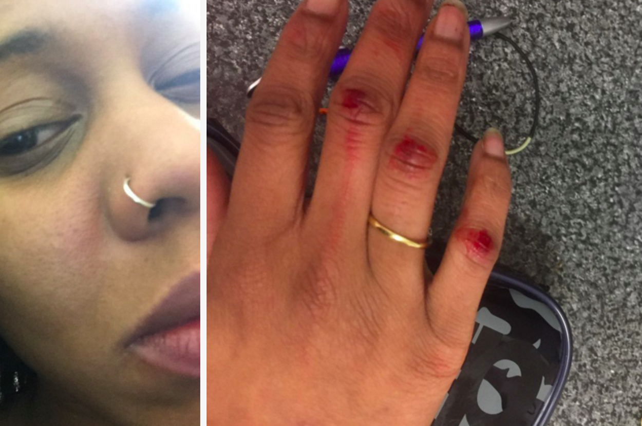This Woman Says She Was Violently Assaulted By An Uber Driver