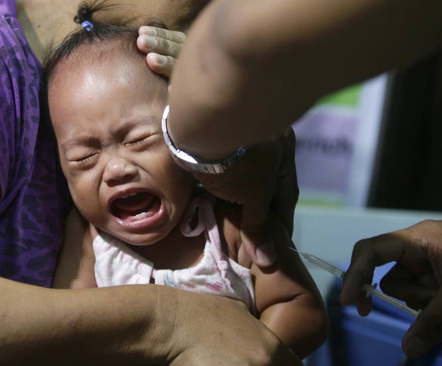 microcephaly newborn causes