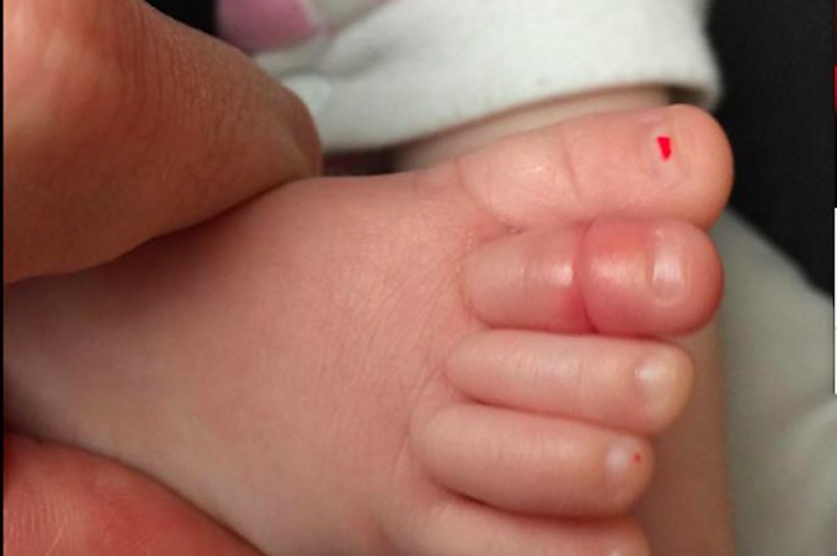 This Dad's Shocking Photo Of His Baby Is Shedding Light On A Dangerous ...