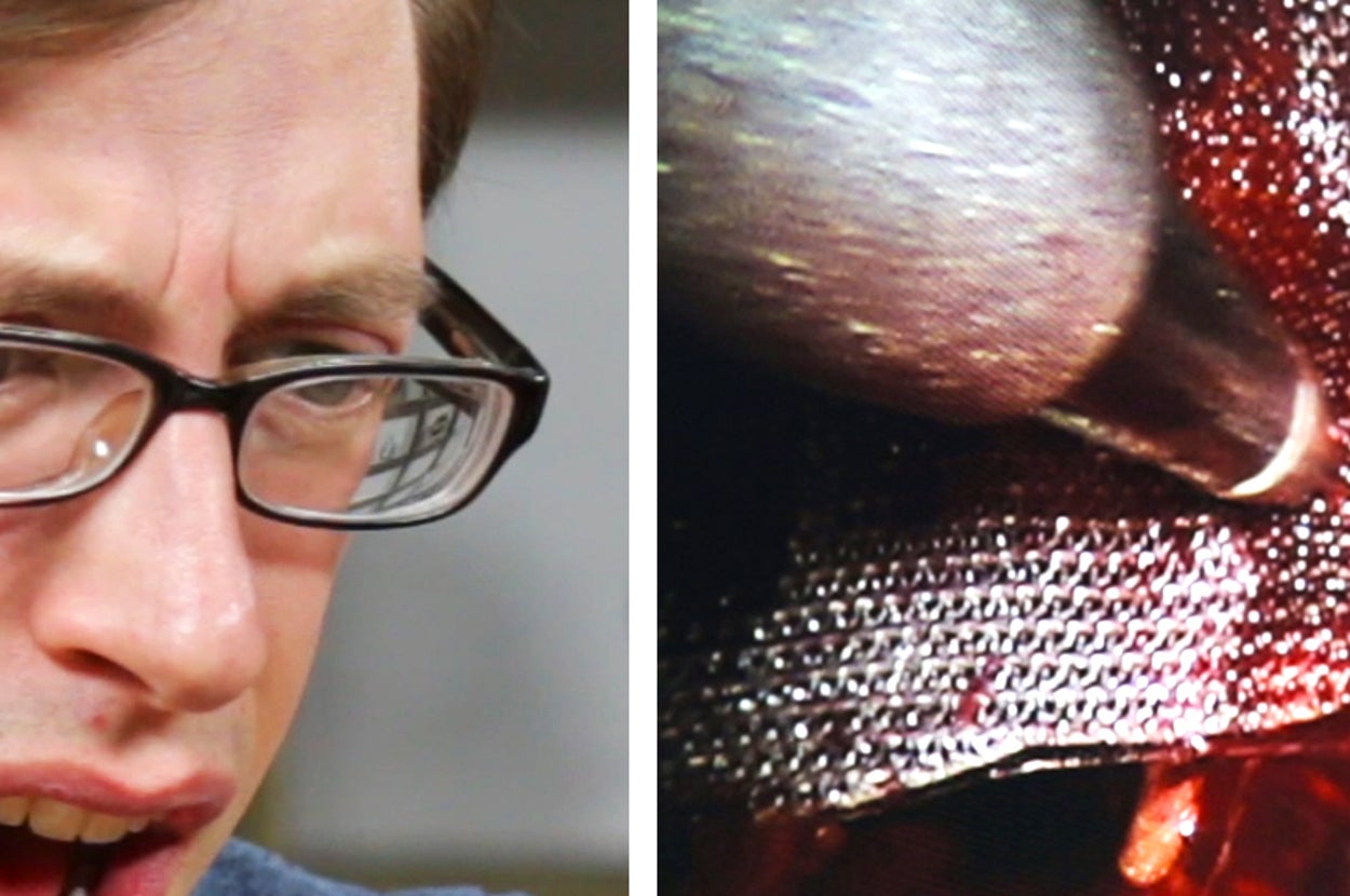 Keith Watched His Own Surgery And It Was Actually Fascinating