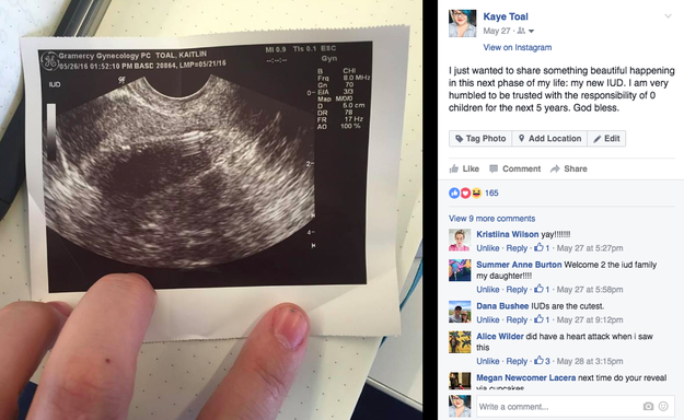 I Got An IUD And This Is What I Learned - BuzzFeed News