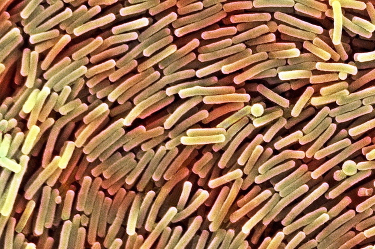 This Could Have Been The First Poop Pill To Hit The Market, But It ...