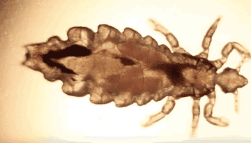 13 Facts About Head Lice That'll Make You Want To Shave Your Head