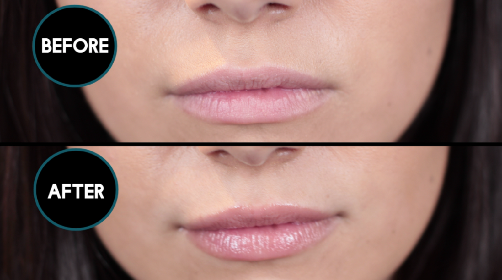 These Women Tries Lip Plumpers And Looked The Same