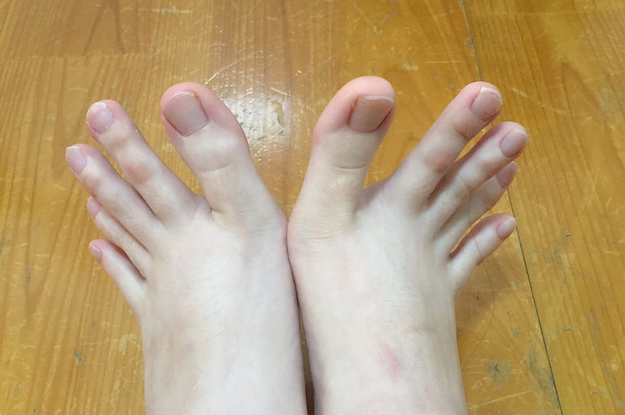 20 Fotos, die Dich fertig machen, wenn Du Füße eklig findest