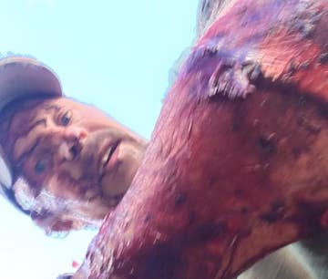 drop bear attack people