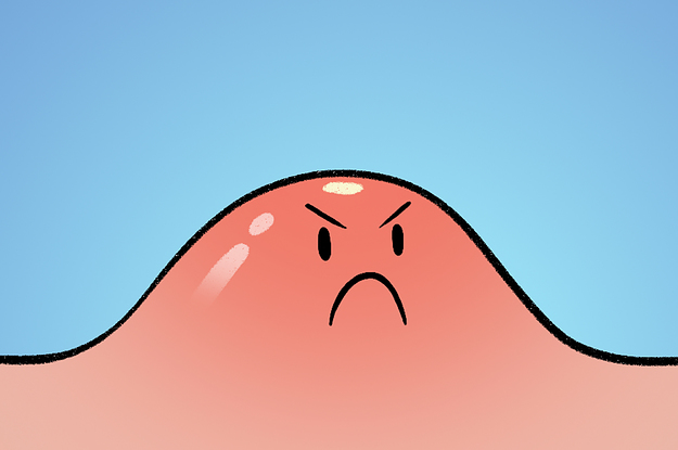 The 6 Stages Of Getting A Zit