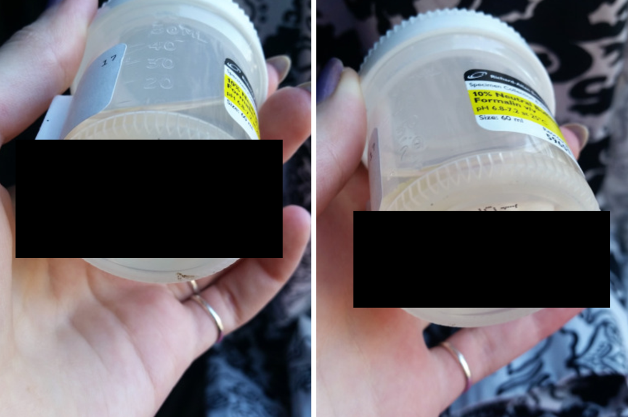 A Tumblr User Mailed Another Tumblr User Her Severed Toe To Make Into A ...