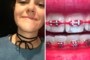17 Tweets That Prove The Choker Trend Is Out Of Control