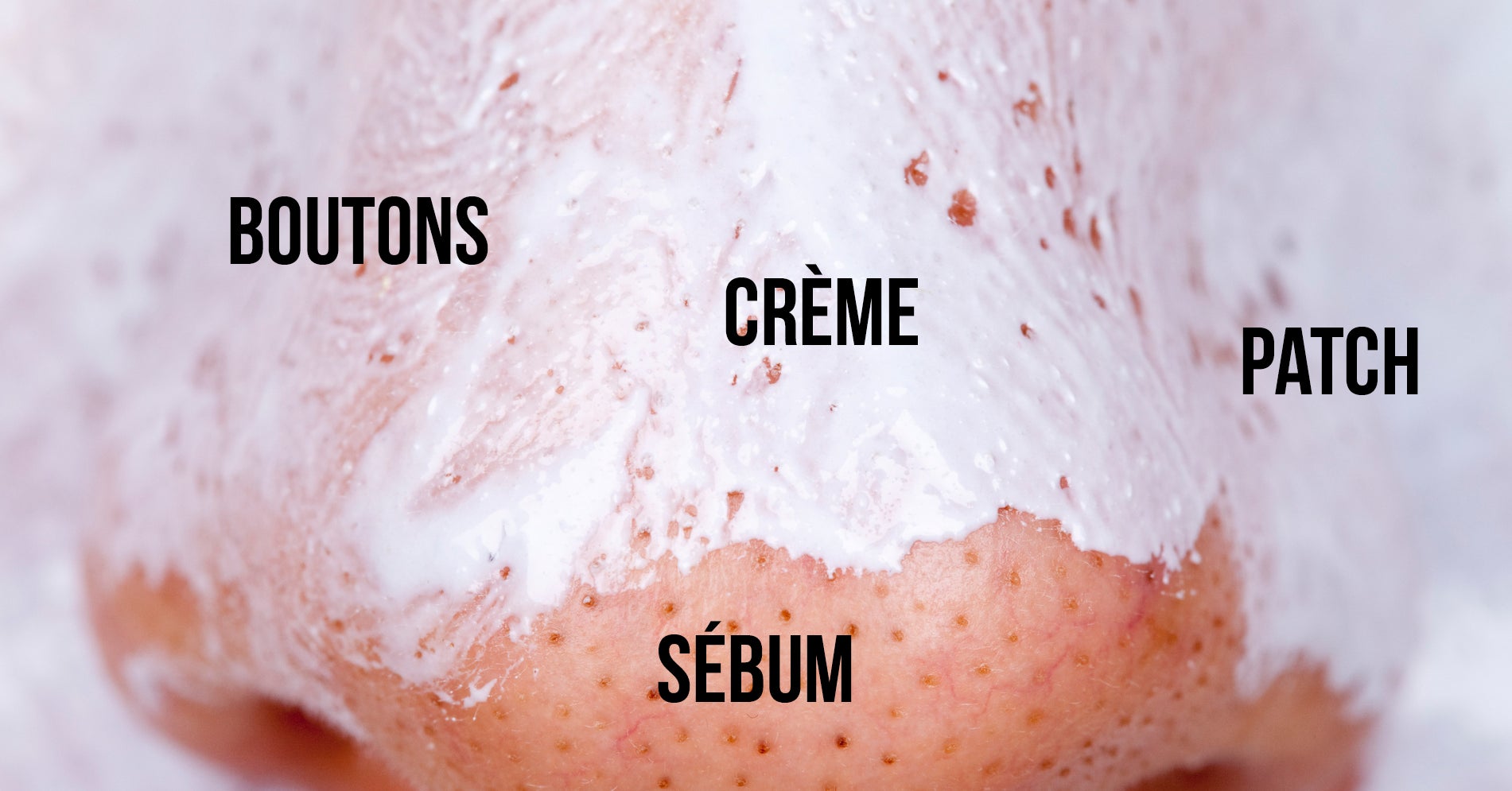 Une dermatologue répond enfin à toutes les questions qu'on a sur la peau