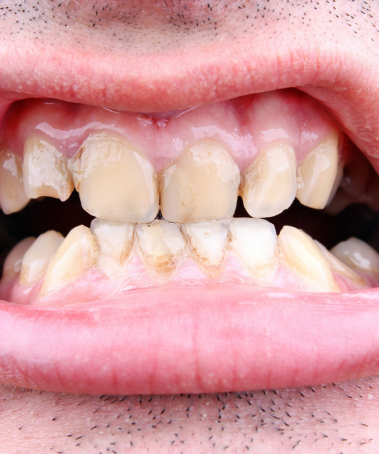 Are These Pictures Too Disgusting Or Not?