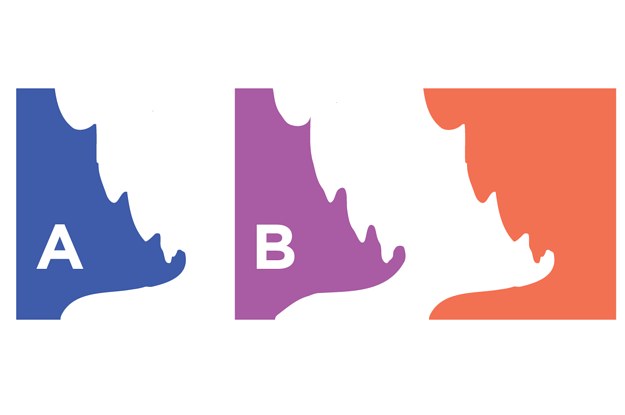 Can You Correctly Identify The Missing Piece?