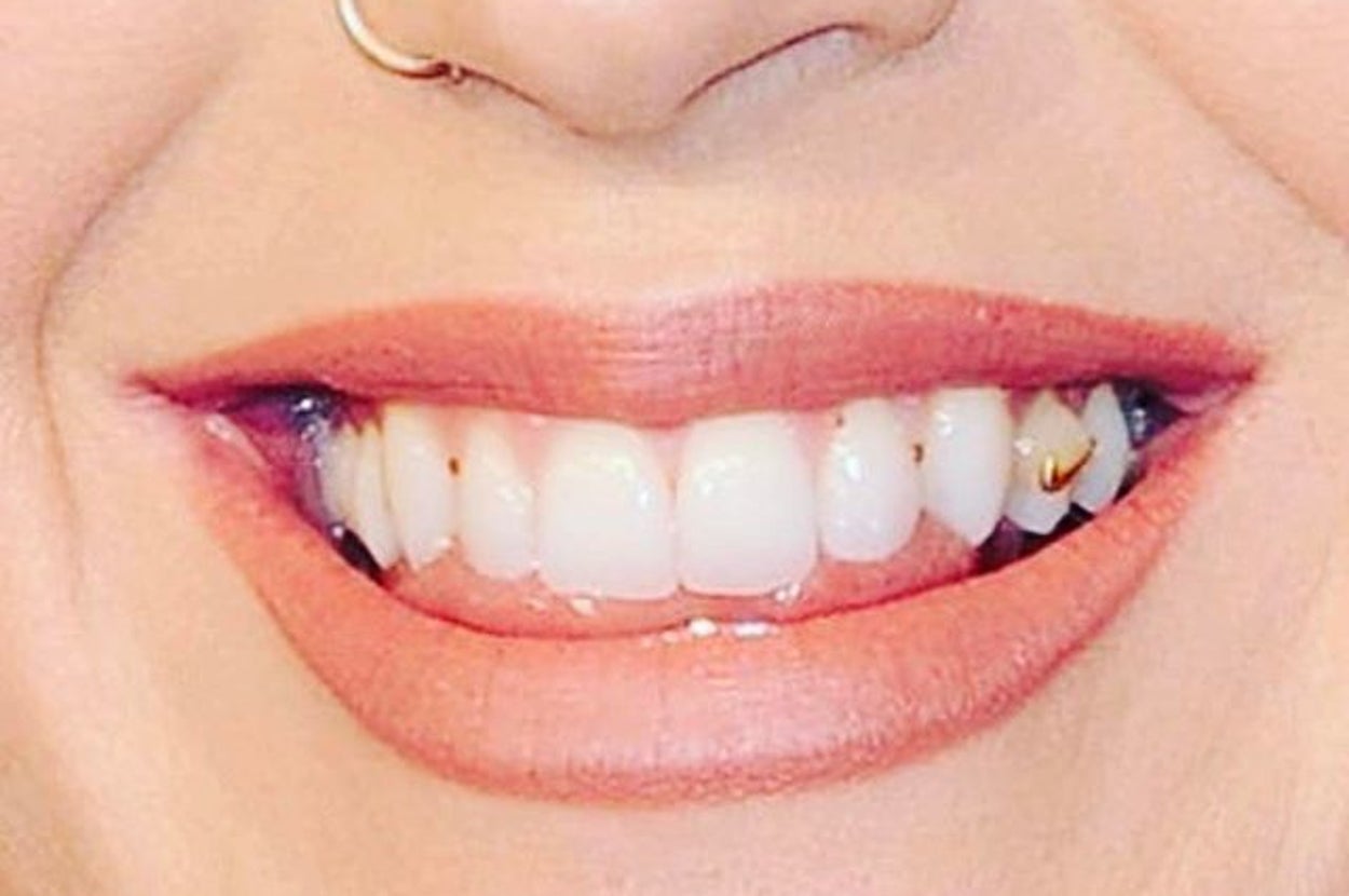 katy perry teeth interview