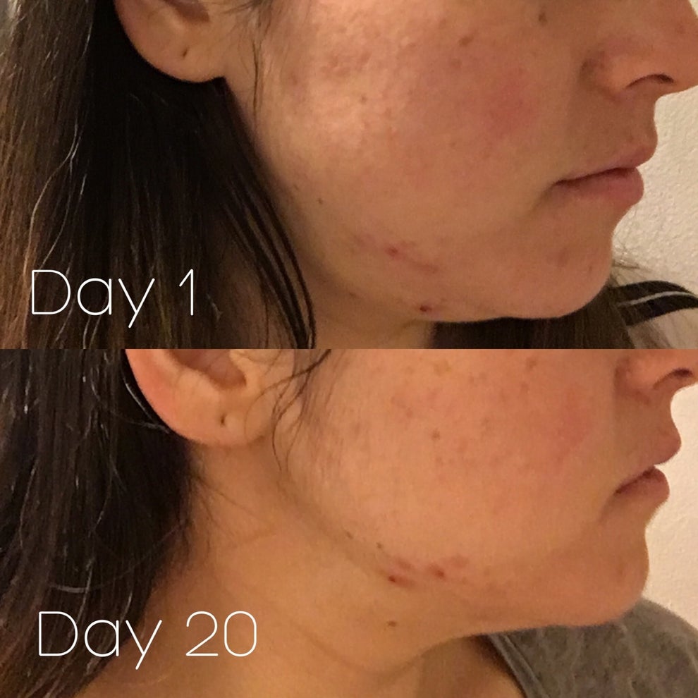 I Quit Sugar For 30 Days And This Is What Happened