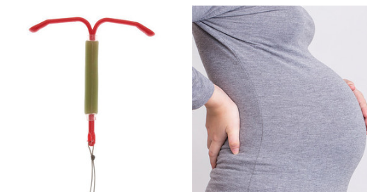 Let's Talk About That Viral Photo Of A Baby Holding An IUD