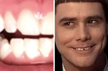 Chipped Tooth Celebrity