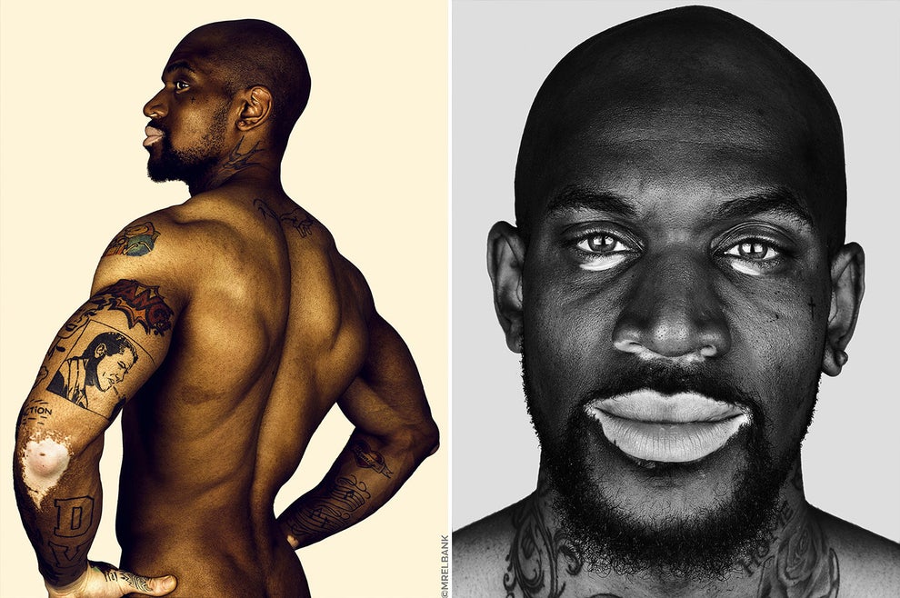 24 Pictures That Capture The Stunning Beauty Of Unique Skin