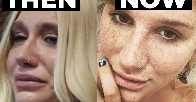Let's Take A Second To Talk About Kesha