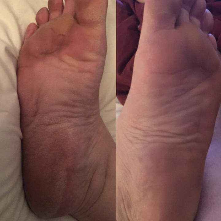 24 Ways To Treat Your Poor, Tired Feet