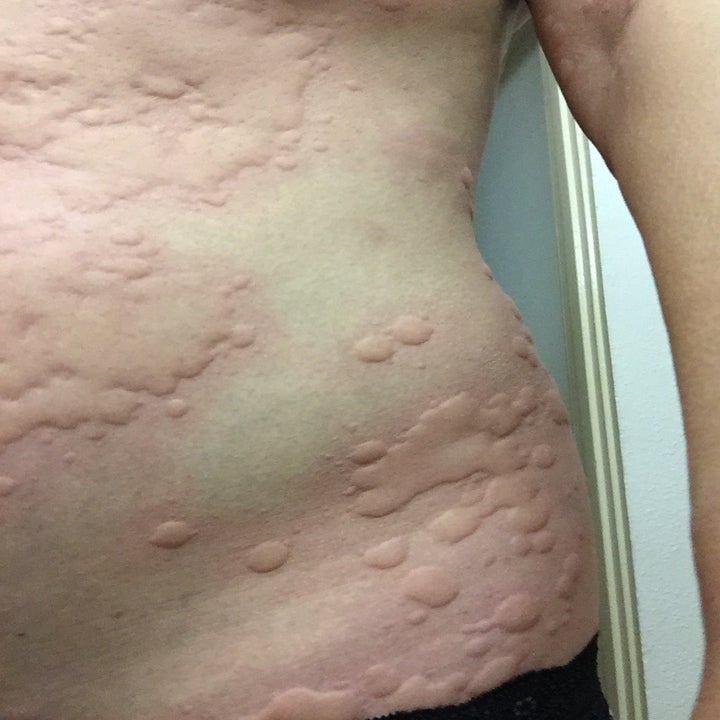 Mysterious Illnesses Are Plaguing People In California After A Massive ...