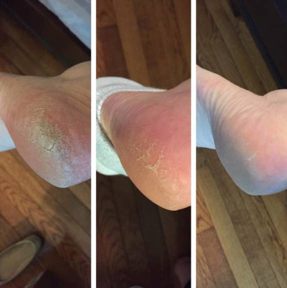 how does working hands work