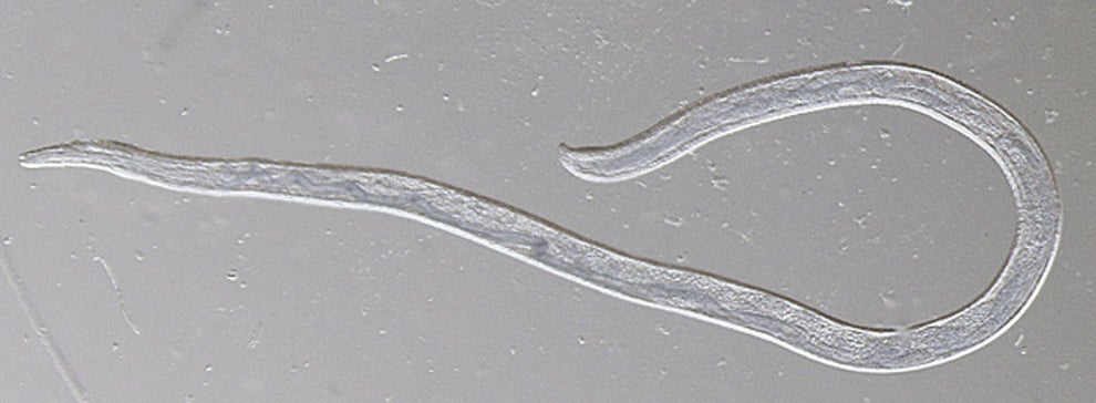 A Woman From Oregon Is The First Person Ever Infected With This Gross ...