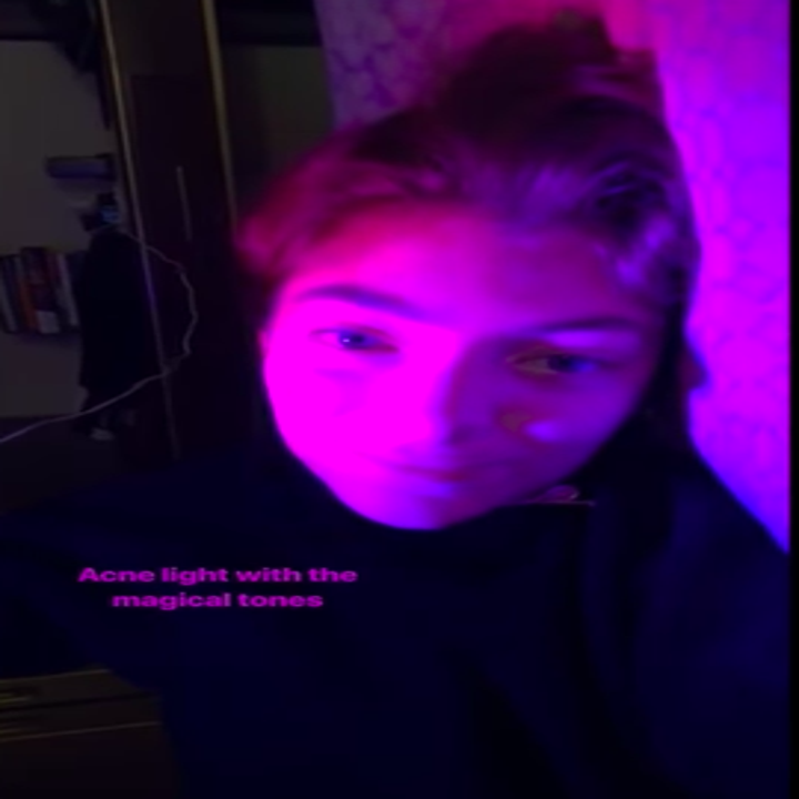 Lorde Totally Nailed Why Acne "Solutions" Are BS For Anyone With ...