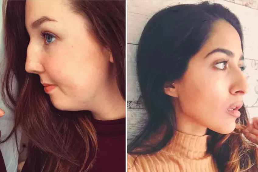 Big Lips Side Profile | Lipstutorial.org