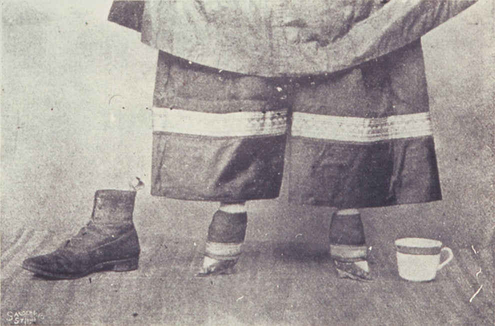 This Is How Chinese Foot Binding Lasted For A Millennium