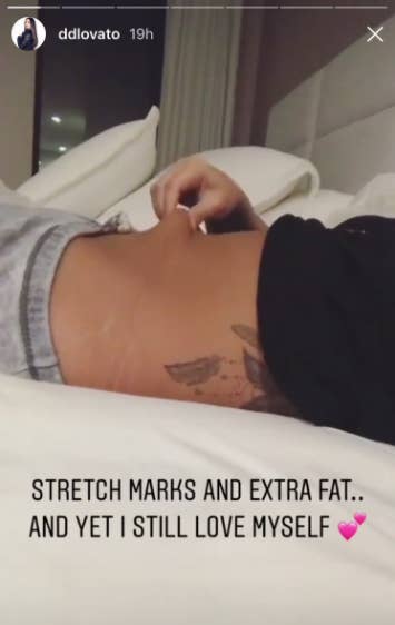 Adele Stretch Marks