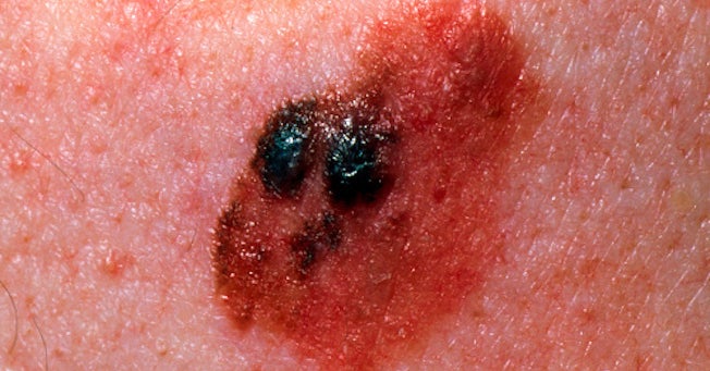 An Expert Dermatologist Weighs In On The Controversial "Base Tan" Theory