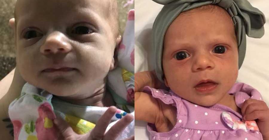 Mom Shares Photo Of Her Baby After Dramatic Weight Loss Due To ...