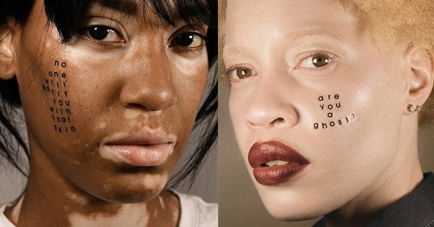Skin Isn't Perfect And This Amazing Photo Series Proves We're All Beautiful