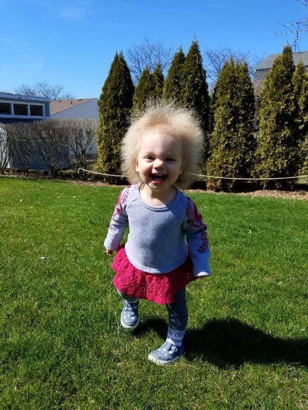 Static Hair Baby