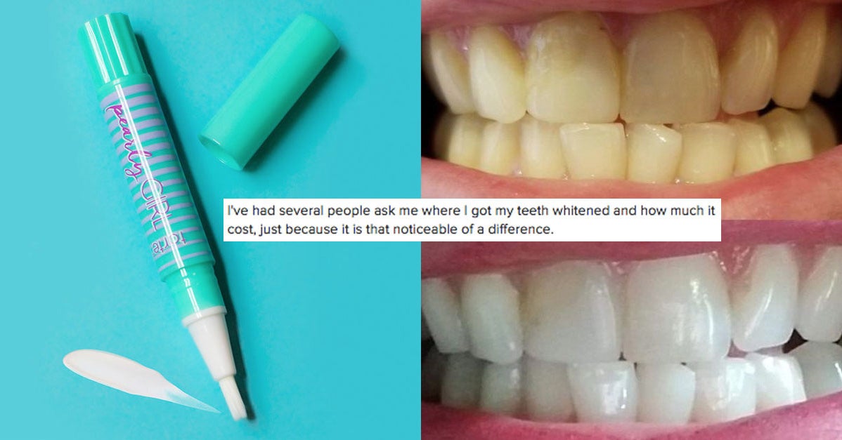 24 Of The Best Teeth Whiteners That You Can Get Online In 2018