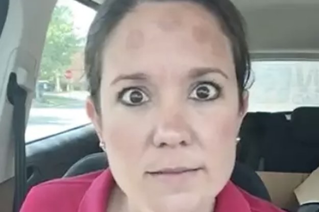 This Woman Covering "Forehead Hickies" With Fake Bangs Is Actually Amazing