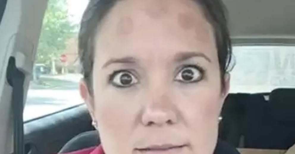 This Woman Hiding "Top Face Hickies" With Fake Bangs Is Actually Very Funny