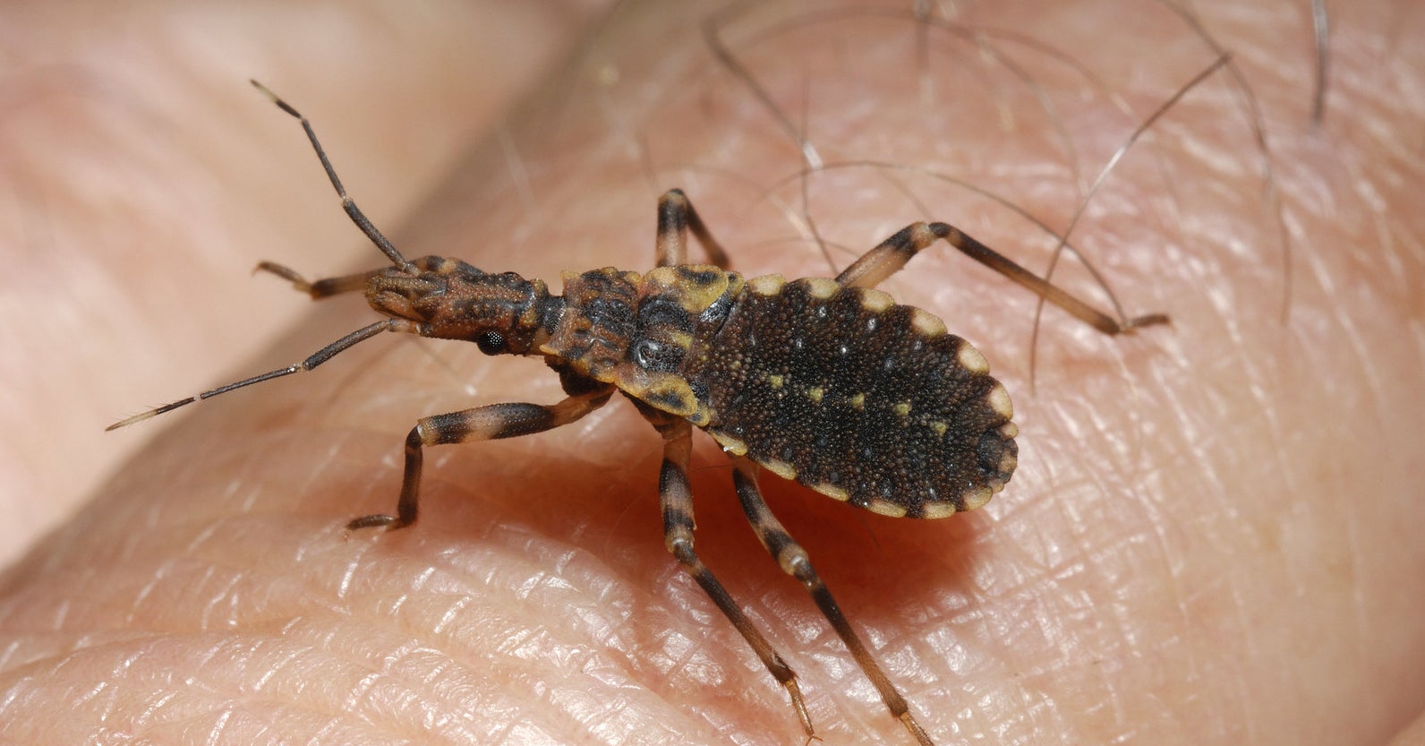 A Parasitic Infection That Causes Heart Disease Is On The Rise In The US