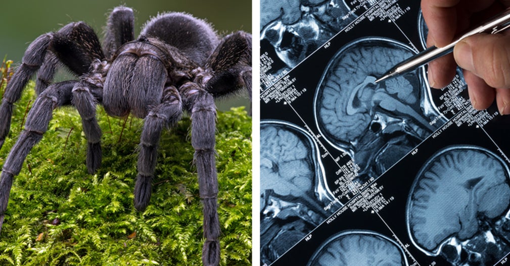 Spider Venom Could Be The Cure For This Rare And Deadly Type Of ...