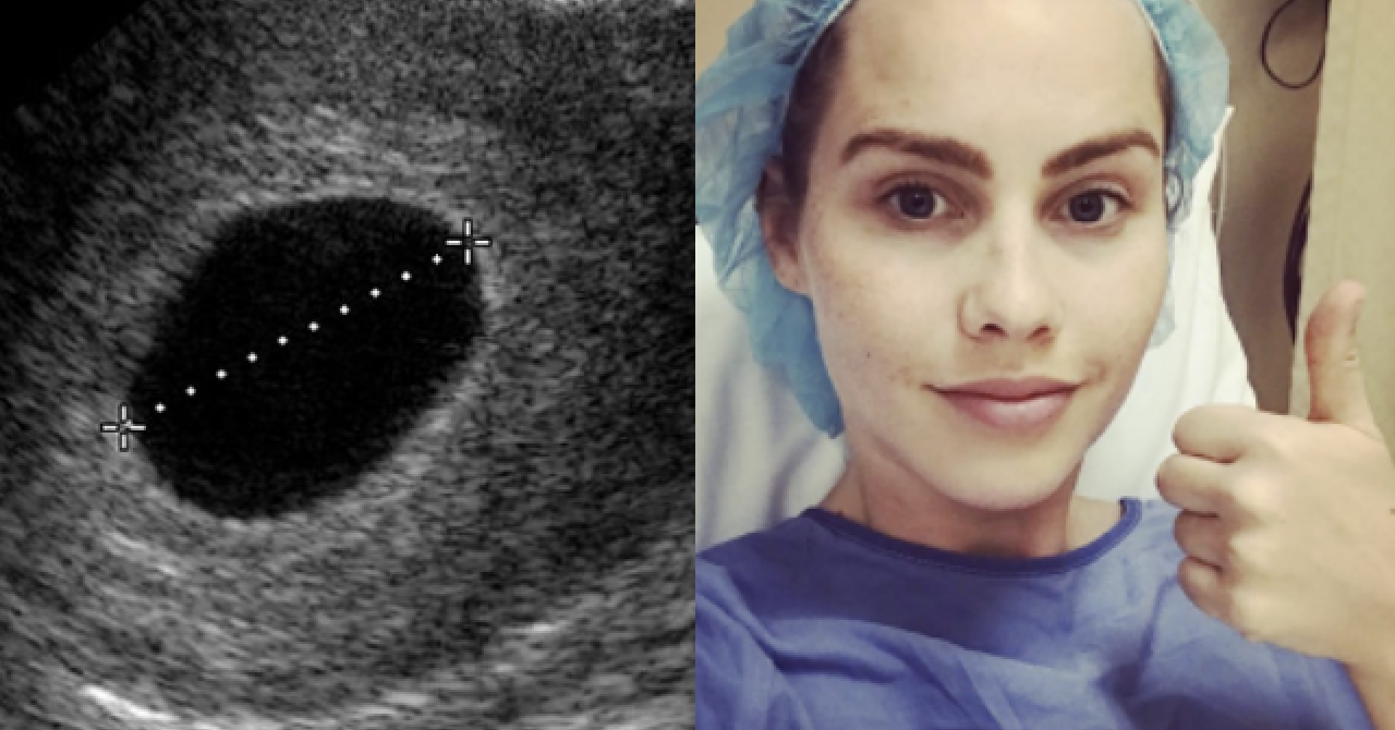What People Who've Suffered Miscarriages Want You To Know