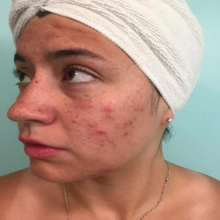 31 Amazing Skin Care Products With Over 1,000 Reviews